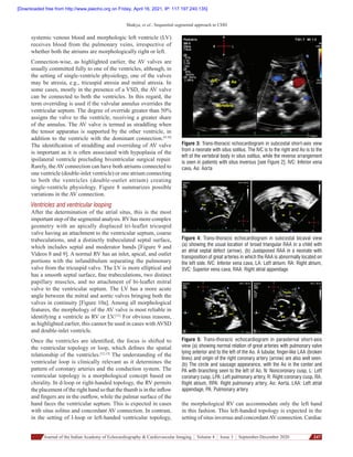 Sequential segmental approach to congenital heart disease | PDF