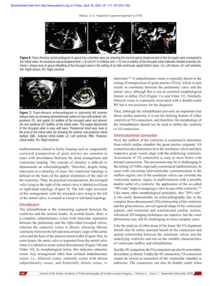 Sequential segmental approach to congenital heart disease | PDF