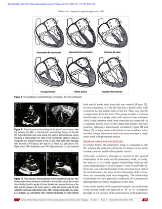 Sequential segmental approach to congenital heart disease | PDF
