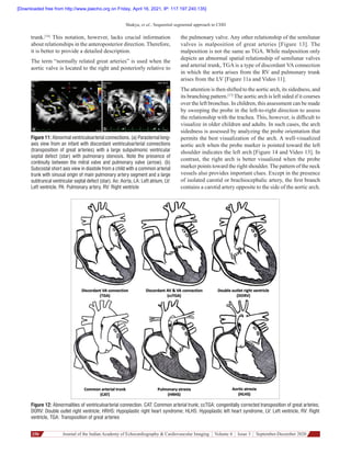 Sequential segmental approach to congenital heart disease | PDF