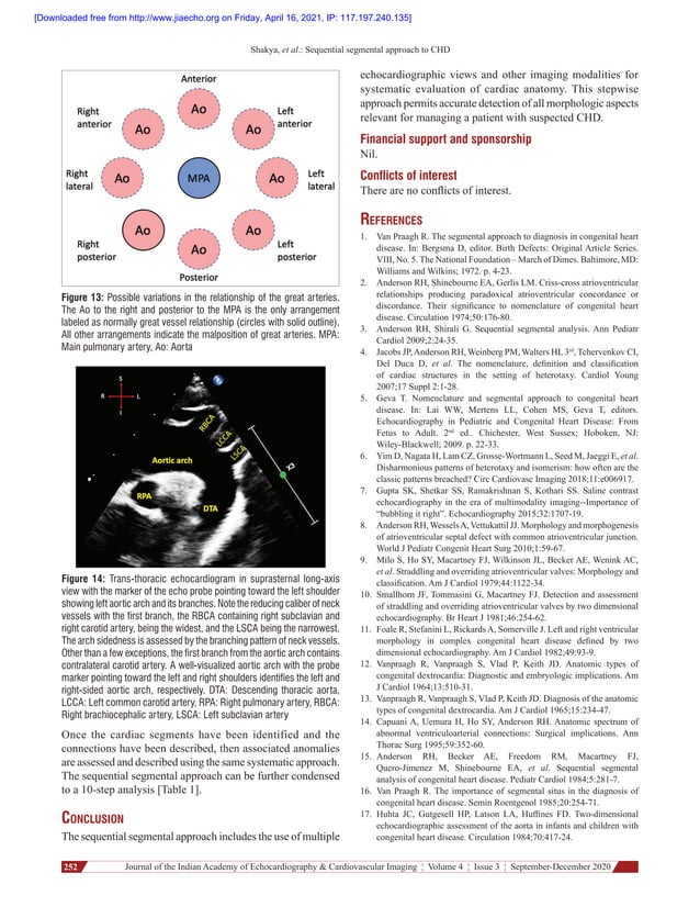 Sequential segmental approach to congenital heart disease | PDF