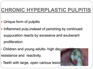 sequle of pulpitis.pptx