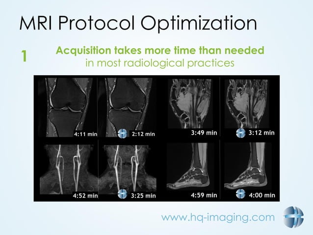 MRI Protocol Optimization | PDF | Medical Tests | Medical Health