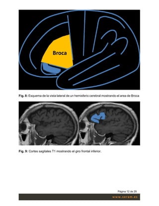 Surcos y giros cerebro | PDF