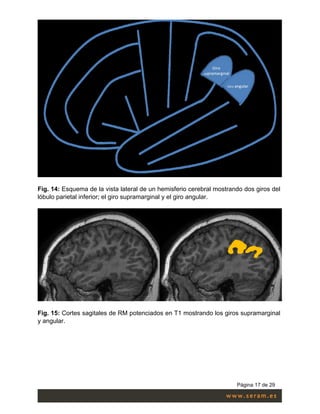 Surcos y giros cerebro | PDF
