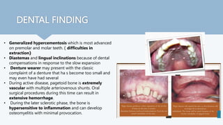 Paget's Disease | PPTX