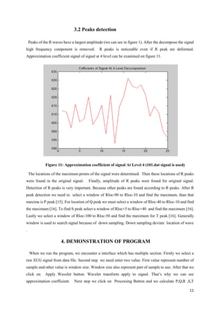 DETECTION OF DISEASES USING ECG | PDF | Graphics Software | Computer Software and Applications