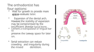Serial exctraction in orthodontic treatment.pptx