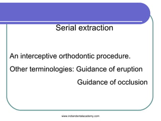Serial extraction /certified fixed orthodontic courses by Indian dental ...