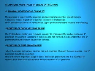 Serial extraction | PPT