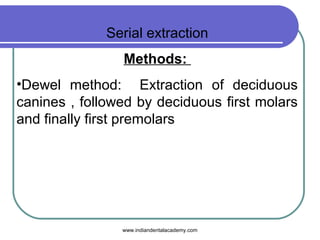 Serial extraction | PPT | Dental Health | Diseases and Conditions