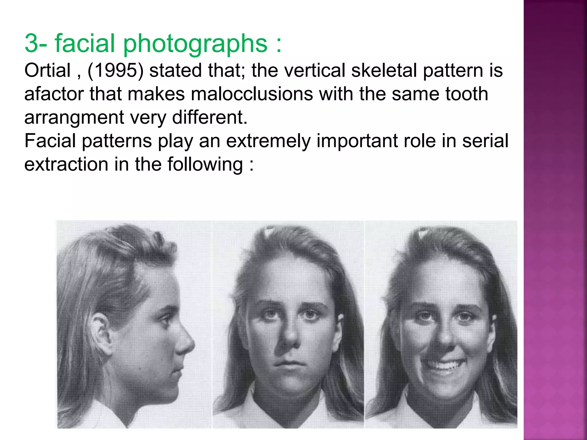 Serial extraction in orthodontic | PPT | Dental Health | Diseases and ...