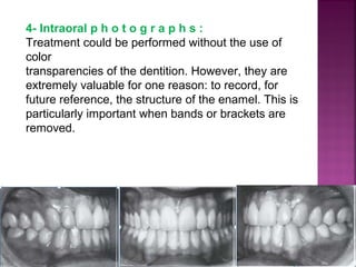 Serial extraction in orthodontic | PPT