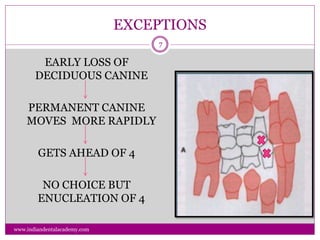 Serial extraction and growth changes/prosthodontic courses | PPTX ...