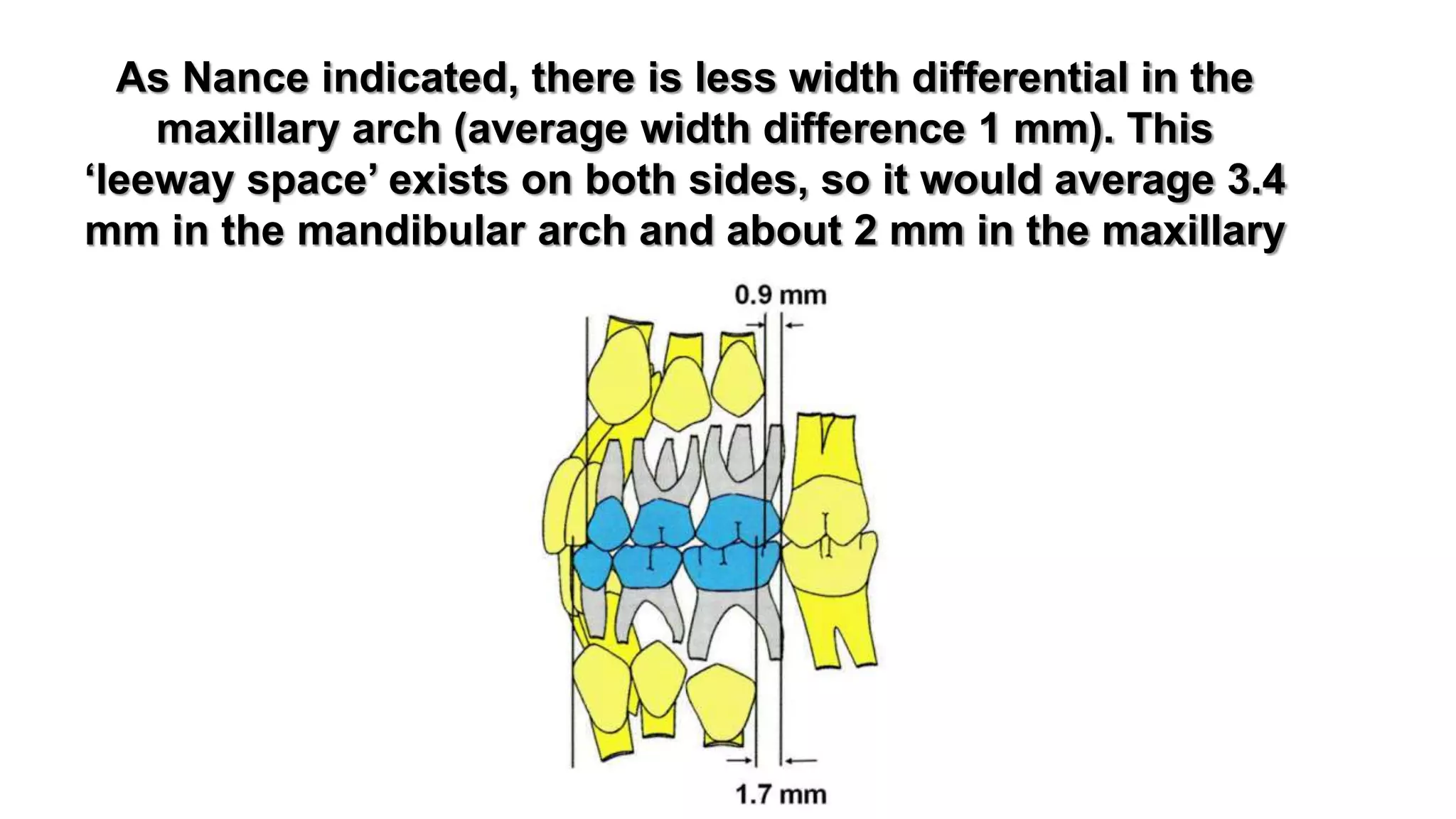 Serial extraction of class i malocclusion | PPTX