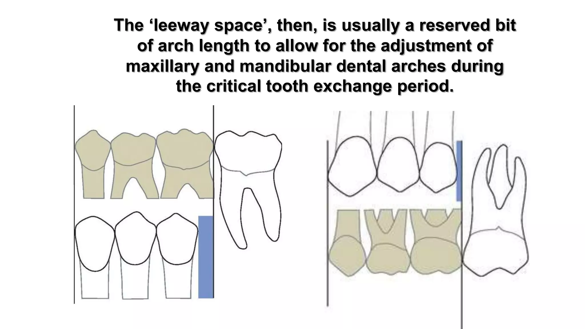 Serial extraction of class i malocclusion | PPTX