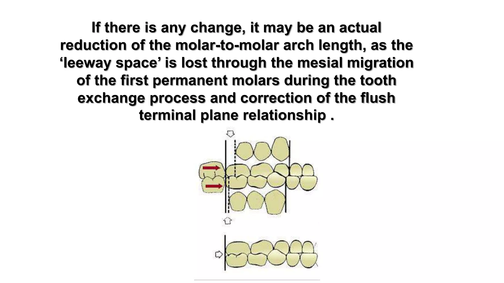 Serial extraction of class i malocclusion | PPTX