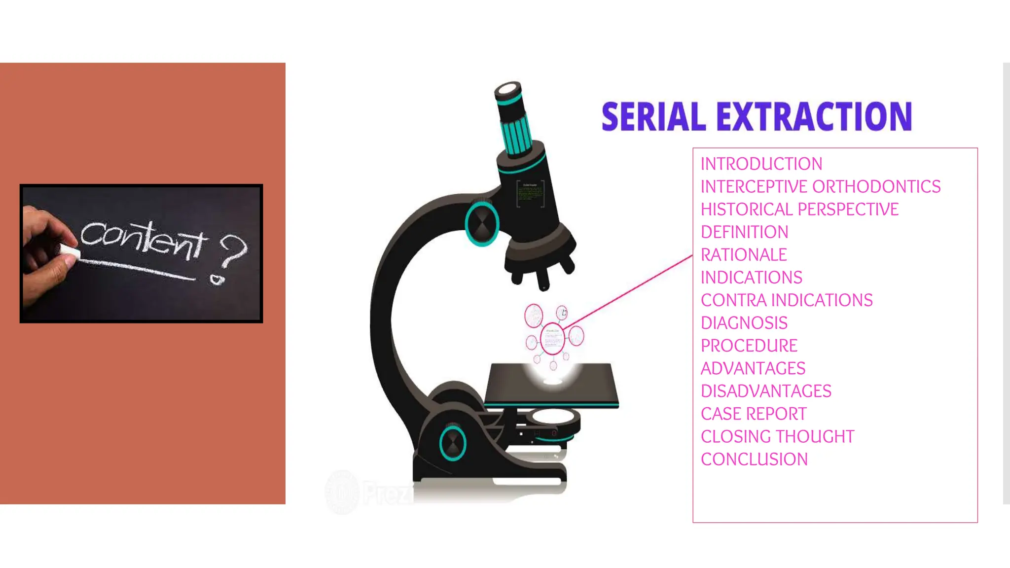 serial extraction pedo (1).pptx