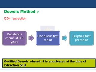 SERIAL EXTRACTION SLIDESHARE.pptx | Dental Health | Diseases and Conditions