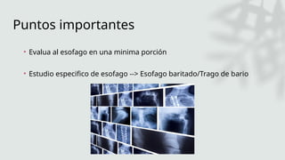 SERIE esofagogastroduodenal jdbbdzjjzjdjdkjd | PPTX