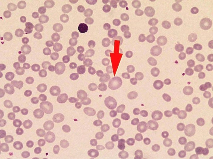 linces clinicos: BIOMETRIA HEMATICA
