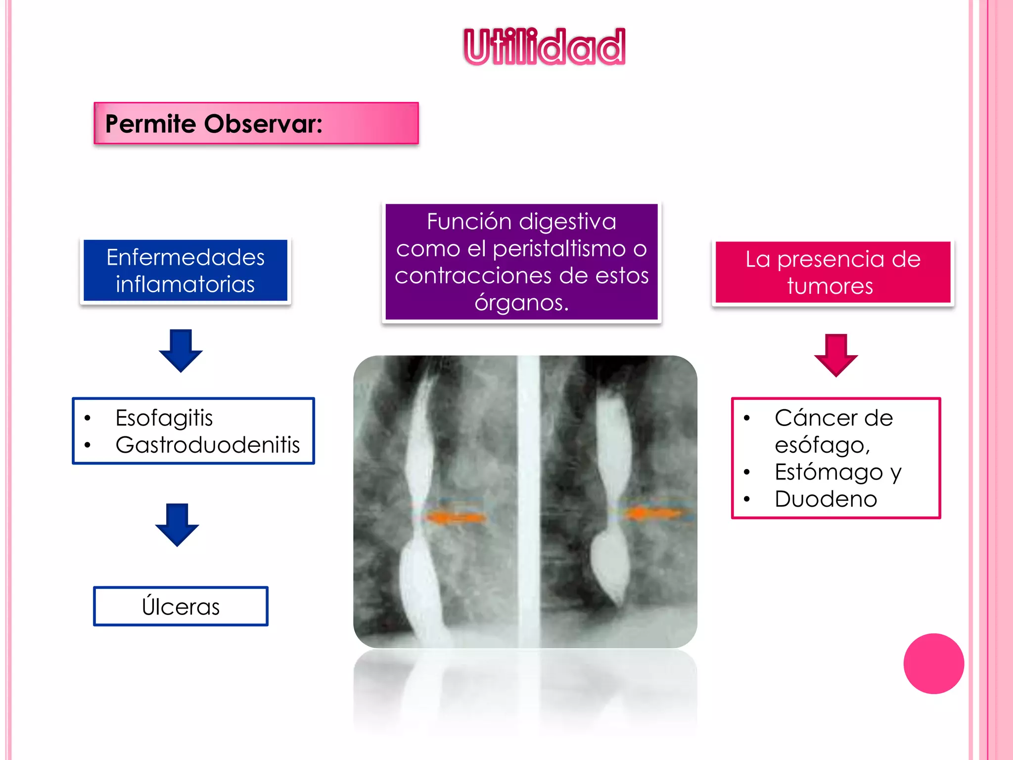 Esofagogastroduodenal ~ Estudios Radiologicos S.d – OPHL