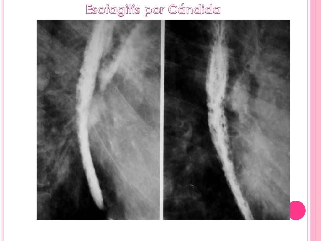 Seed Seriografia Esofago Estomago Duodeno - EDUCA