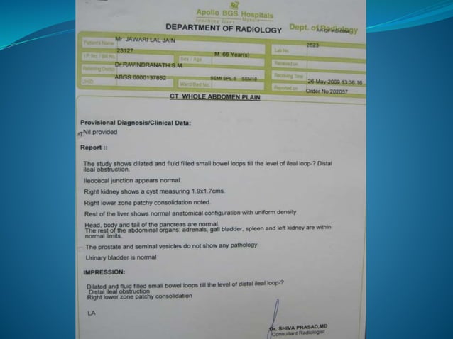 Series of small bowel obstruction | PPT