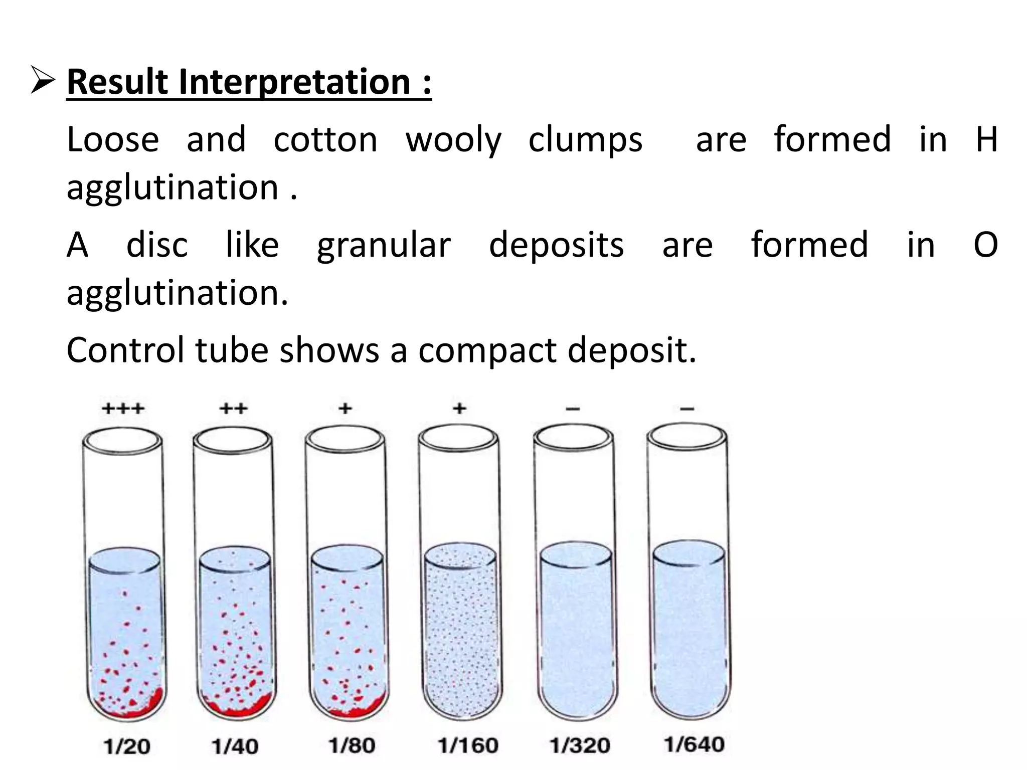 Serological tests-for-the-diagnosis-of-salmonella | PPTX