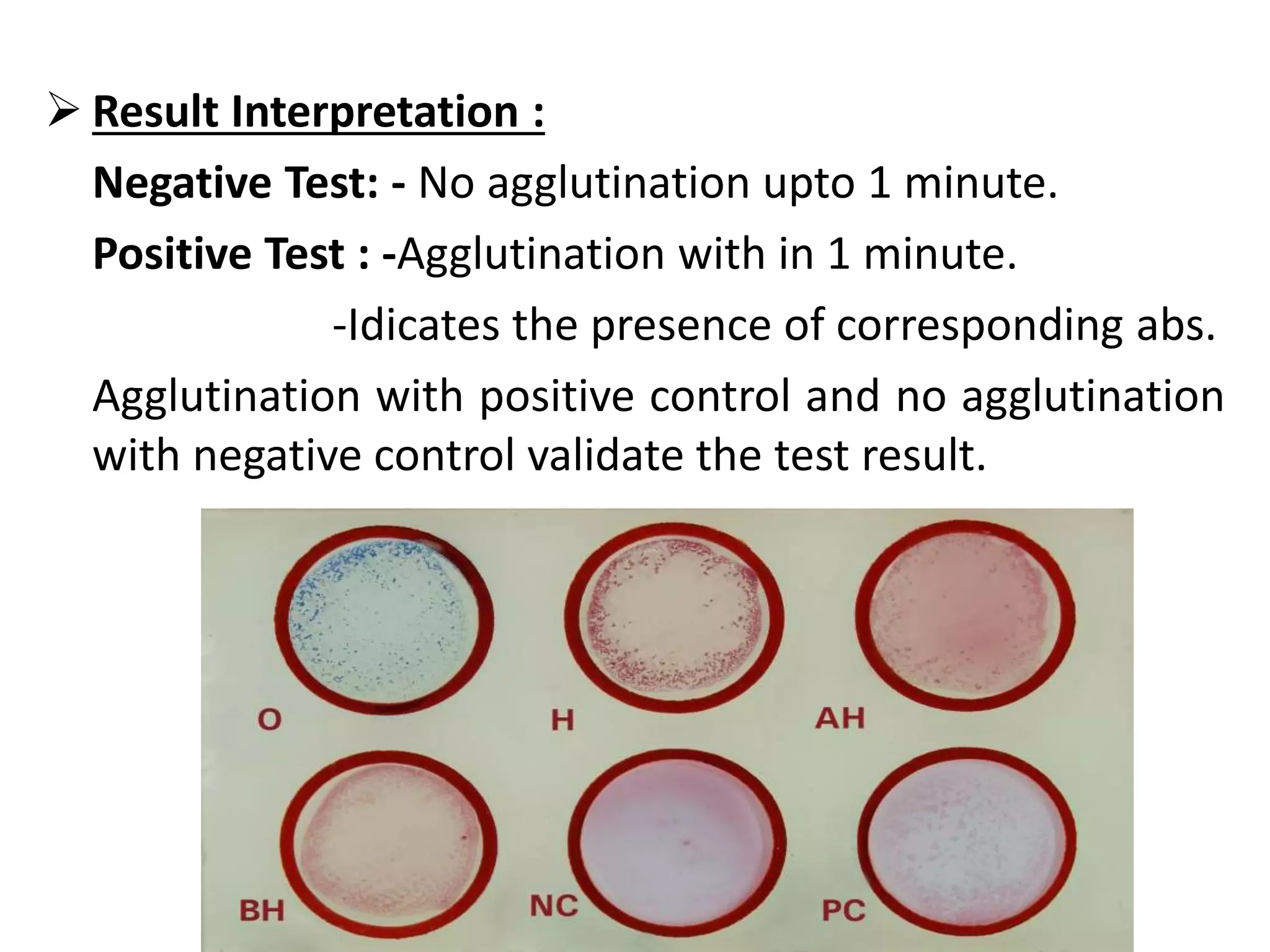 Serological tests-for-the-diagnosis-of-salmonella | PPTX