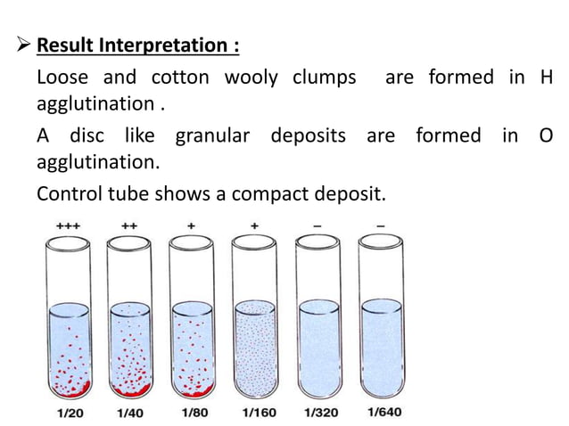 Serological tests-for-the-diagnosis-of-salmonella | PPTX | Infectious ...