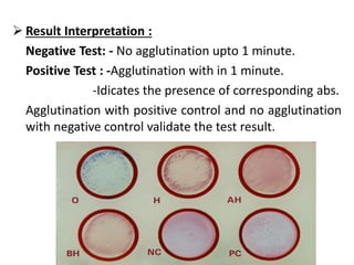 Serological tests-for-the-diagnosis-of-salmonella | PPT