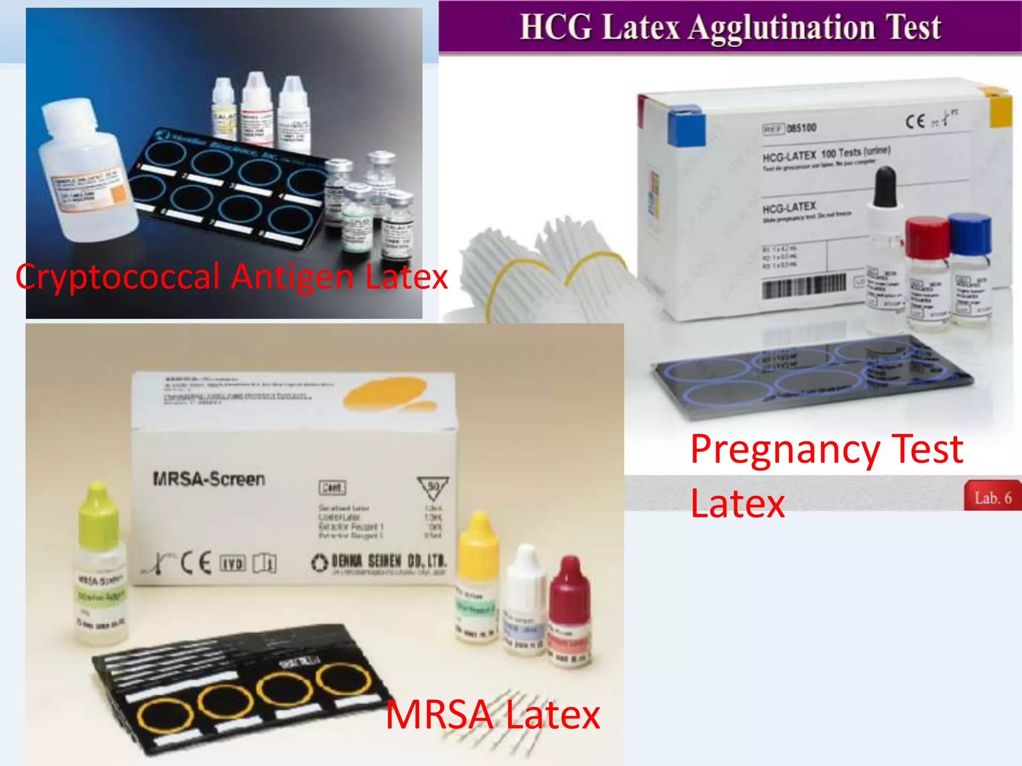 Serological Diagnosis of Infectious Diseases | PPTX