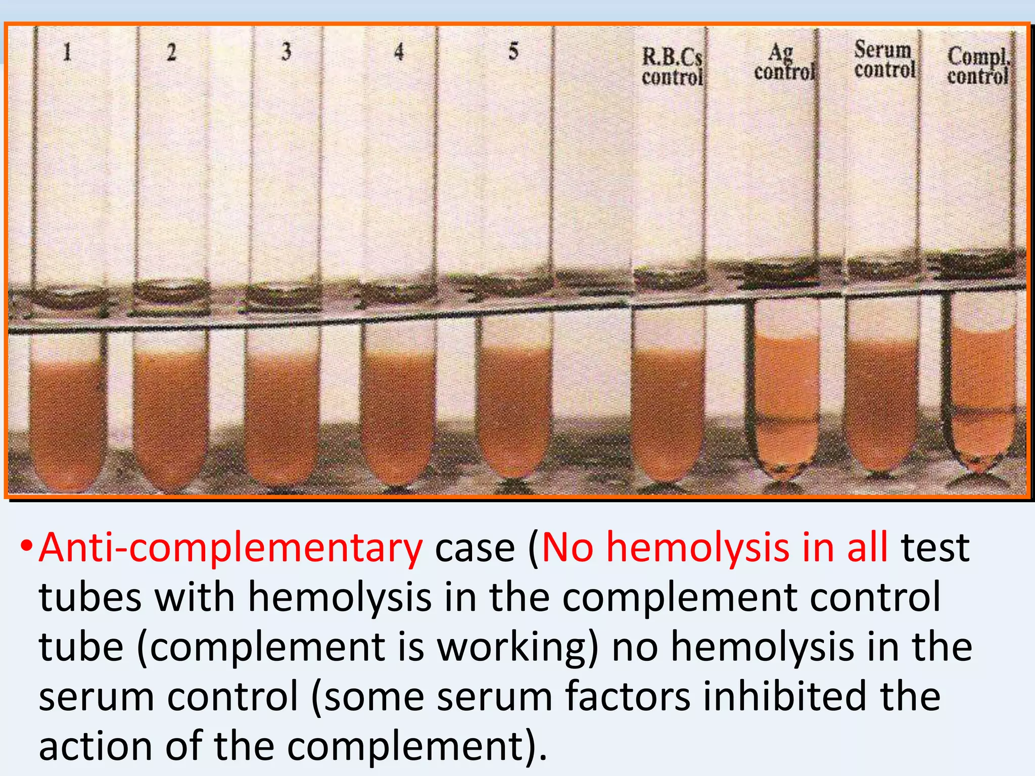 Serological Diagnosis of Infectious Diseases | PPTX