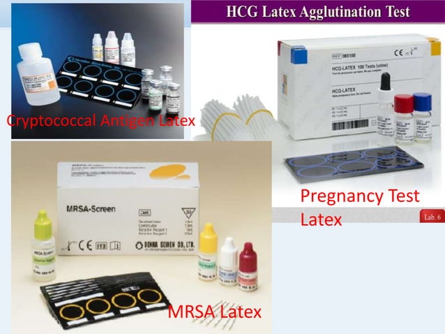 Serological Diagnosis of Infectious Diseases | PPTX | Infectious ...