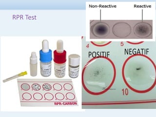 Serological Diagnosis of Infectious Diseases | PPTX