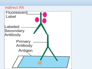 Serological Diagnosis of Infectious Diseases | PPTX