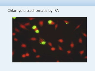 Serological Diagnosis of Infectious Diseases | PPTX