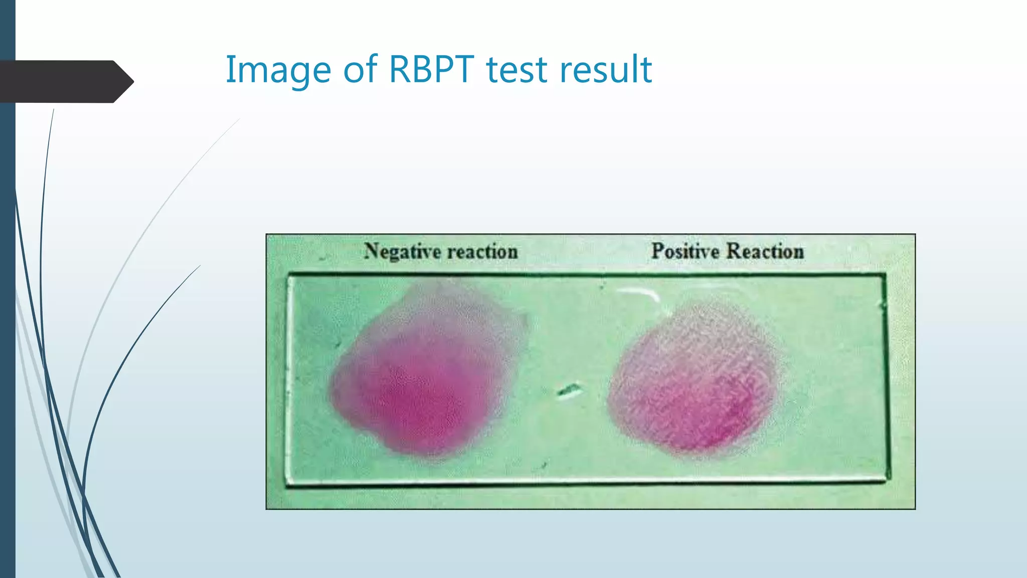Serological evidence of brucellosis in goats | PPTX