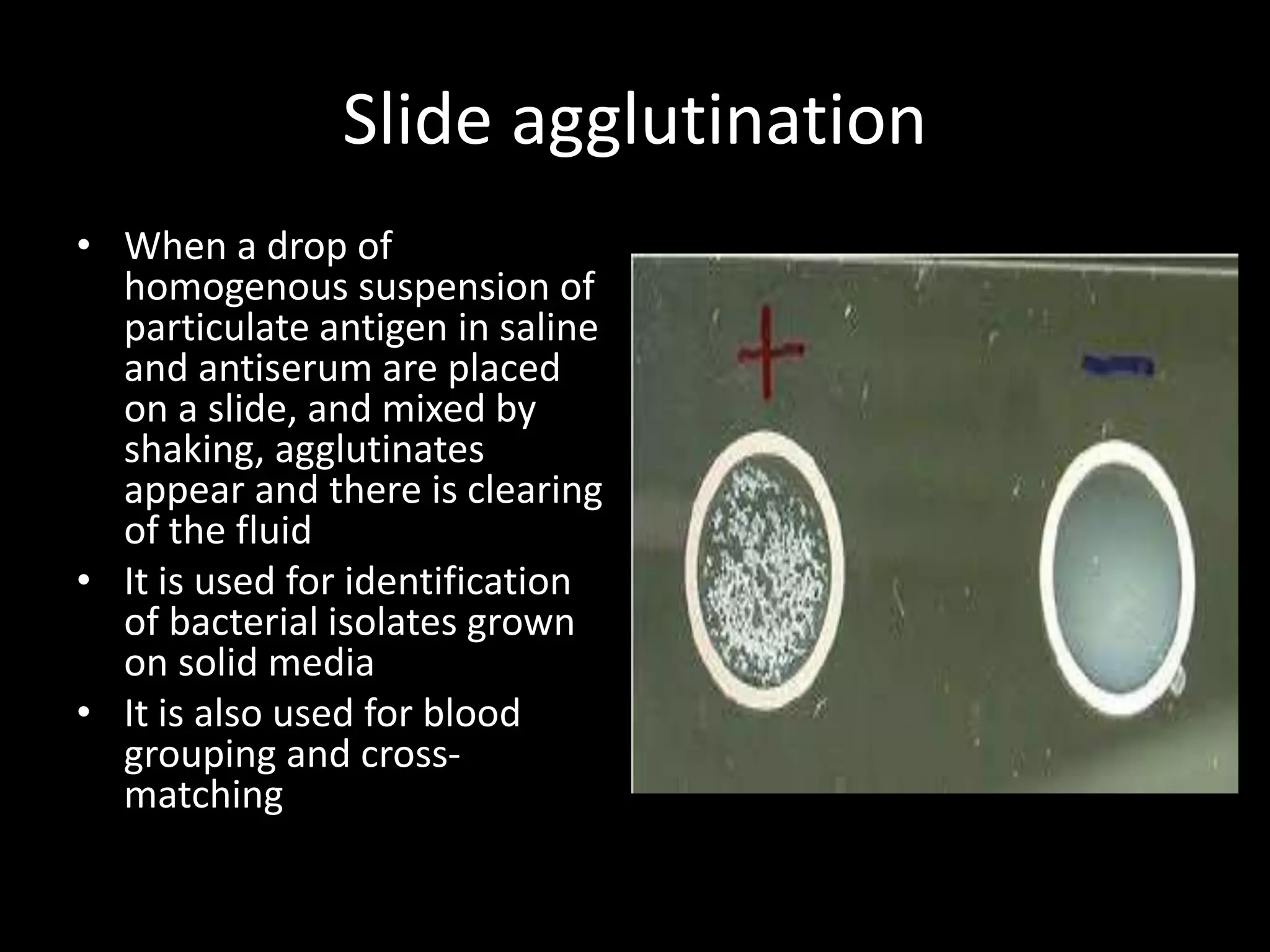 Serological reactions by Dr. Himanshu Khatri | PPTX