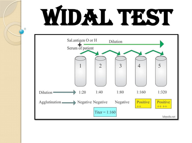 Serological test as widal for diagnosis of disease.pptx
