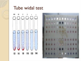 Serological test as widal for diagnosis of disease.pptx
