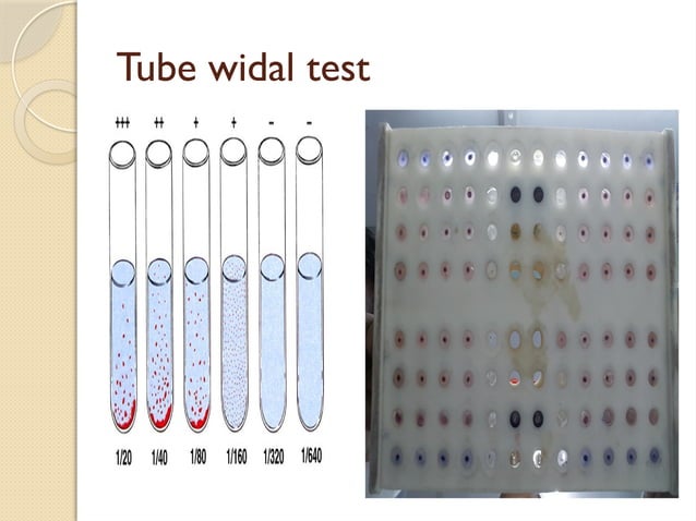 Serological test as widal for diagnosis of disease.pptx