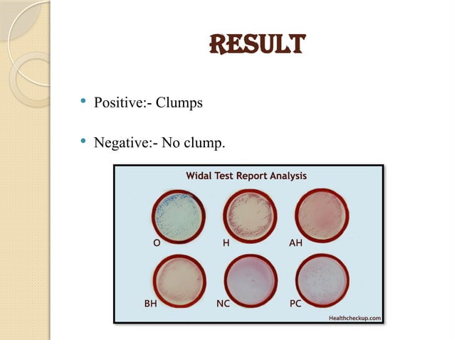 Serological test as widal for diagnosis of disease.pptx | Free Download