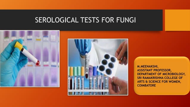Serological test for fungi | PPTX
