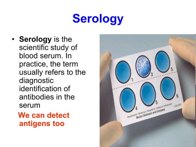 Serology.ppt