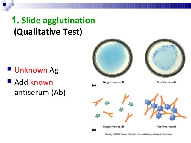 Serology - Prac. Microbiology