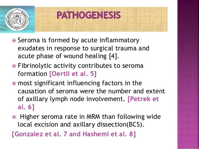 Seroma presentation
