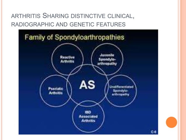 SERONEGATIVE ARTHERITIS in details presentation.pptx