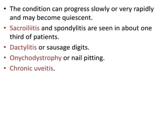 Seronegative Arthropathy.pptx